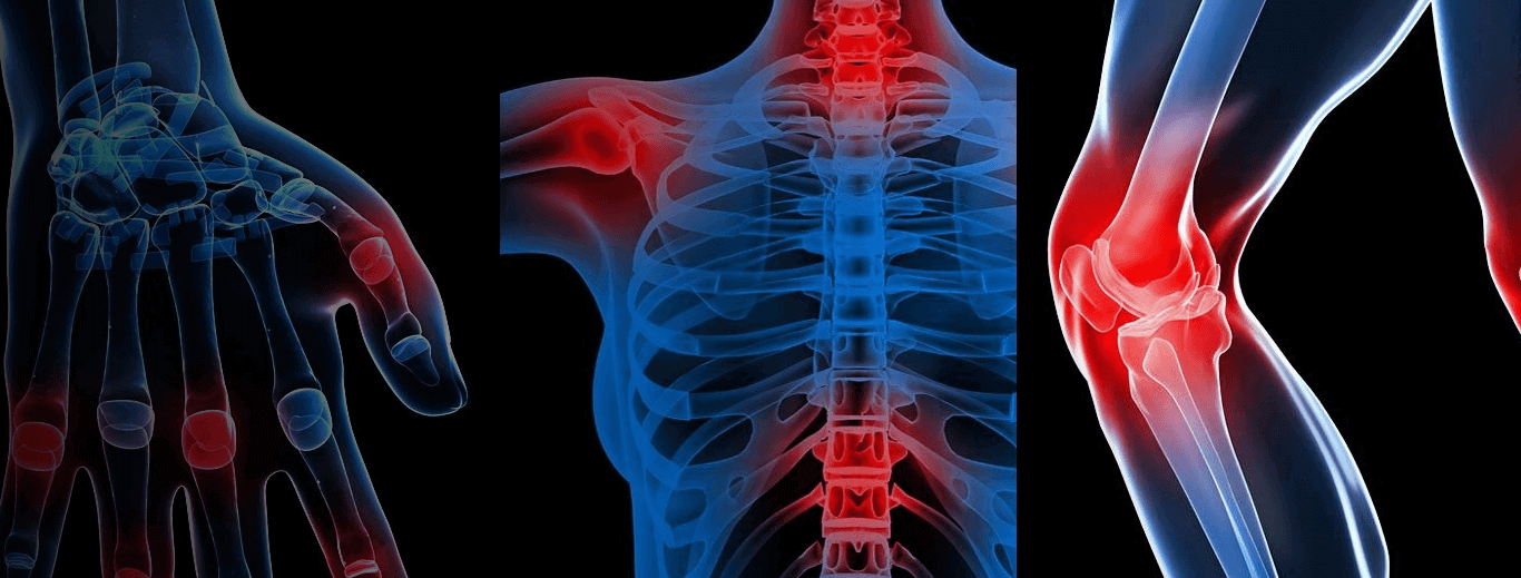 Best Rheumatologist in India | Arthritis Doctor | Rheumatoid Doctor